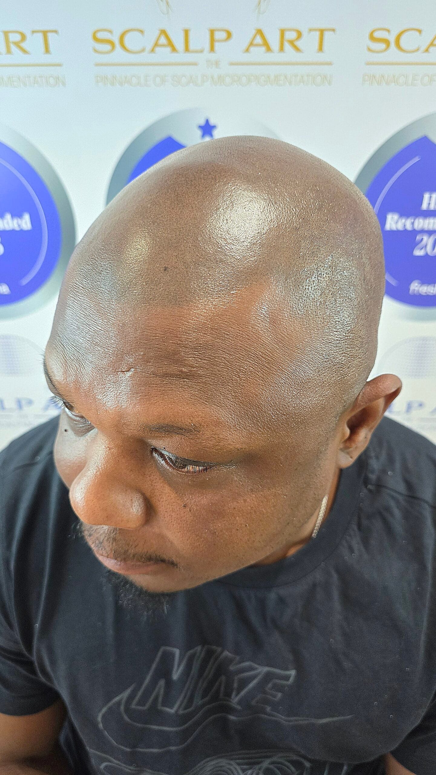 Oliver Young -Scalp Art Clinic -Cosmedicheck